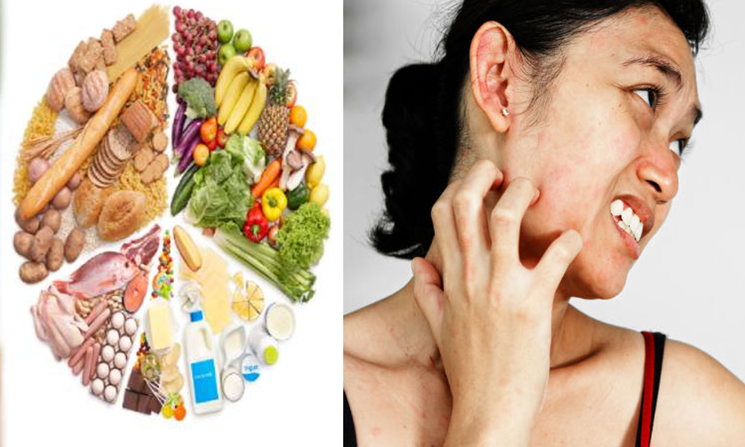 உடலில் அரிப்பை தடுக்கும் உணவுவகைகள் | Foods that prevent corrosion in ...