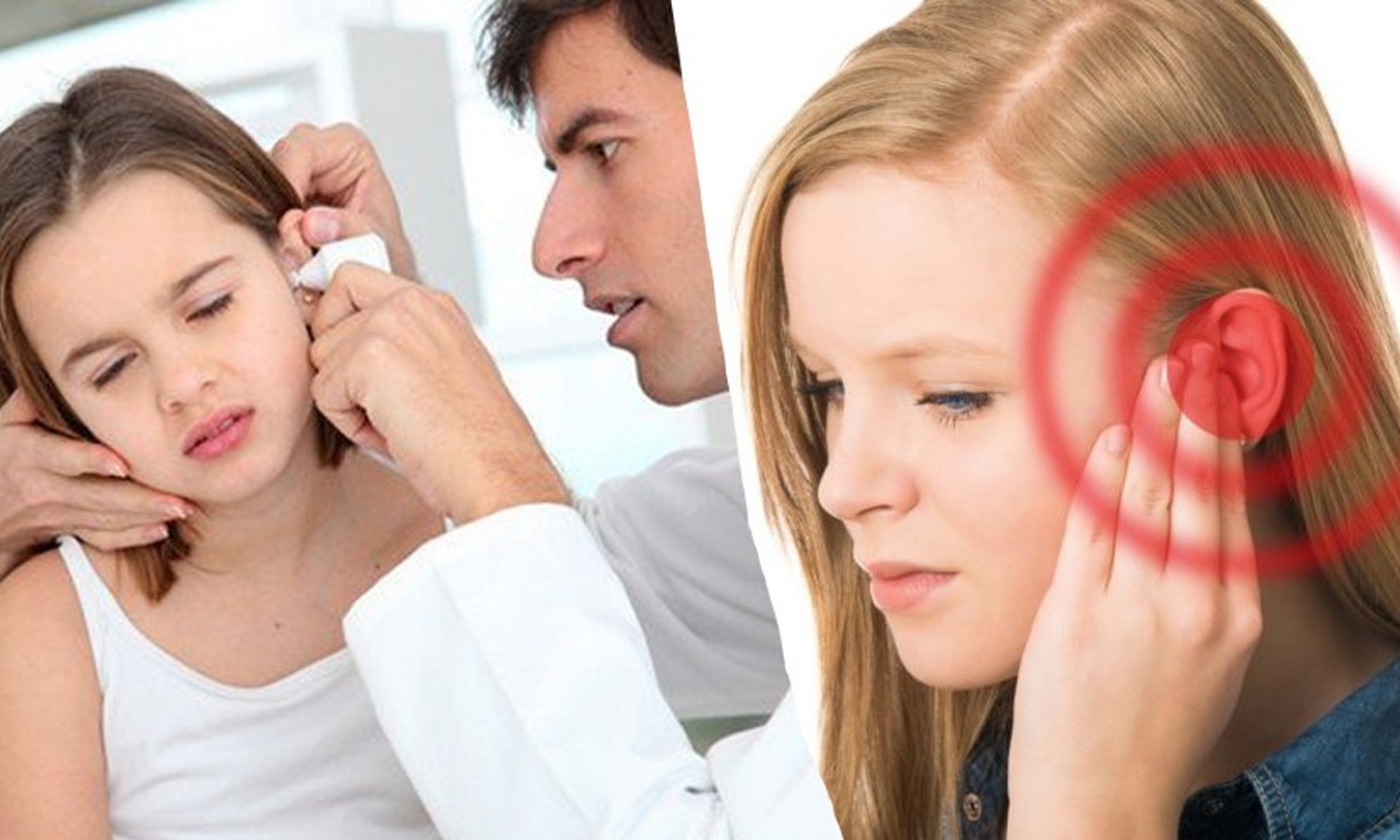 காதுகளில் சீழ் வடிவது ஏன் தெரியுமா...? | Do you know why pus forms in ...