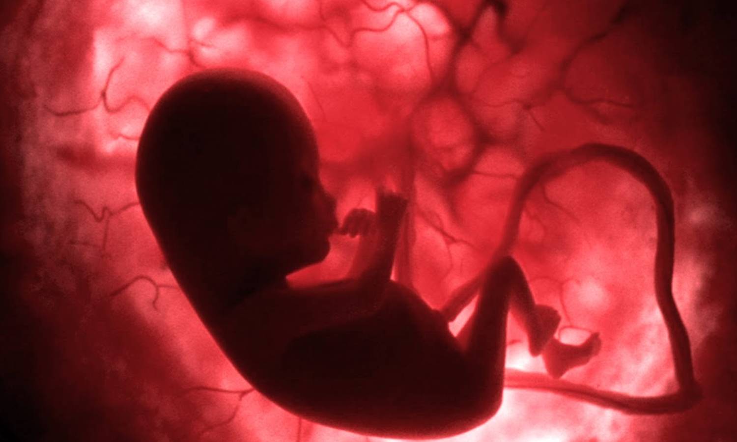 பனிக்குட நீர் குறைவாக இருந்தால் என்ன ஆகும்/What happens if the Amniotic ...